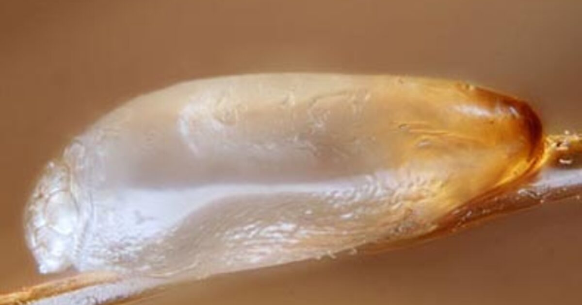 Poux et lentes : comment fonctionne la reproduction - Infos coiffure